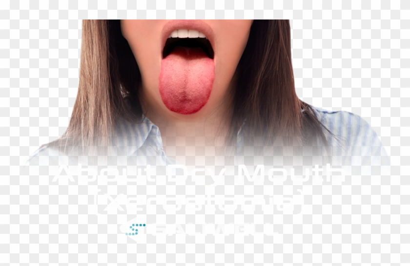 Saliwell About Dry Mouth - Tongue, HD Png Download - 2404x1450(#1024586 ...