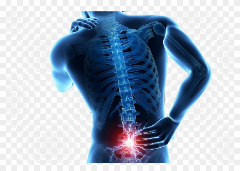 Back Pain Png Transparent - Lesion De Espalda Baja, Png Download ...