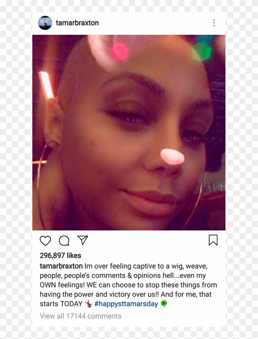 Bald Head Png, Transparent Png - 768x1024(#1990959) - PngFind