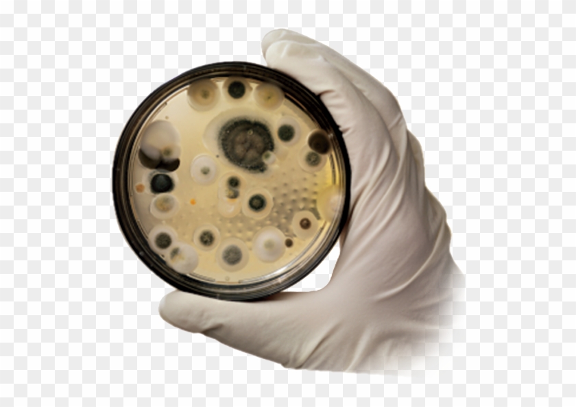 Mold Removal - Image Png - Black Mold, Transparent Png - 575x622 ...