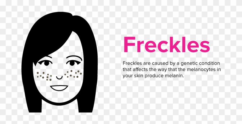 Freckles Png - Cartoon, Transparent Png - 800x400(#298487) - PngFind