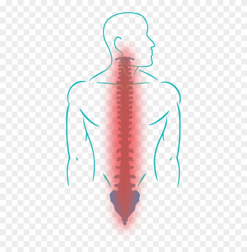 Back Pain - Illustration, HD Png Download - 606x865(#3365731) - PngFind