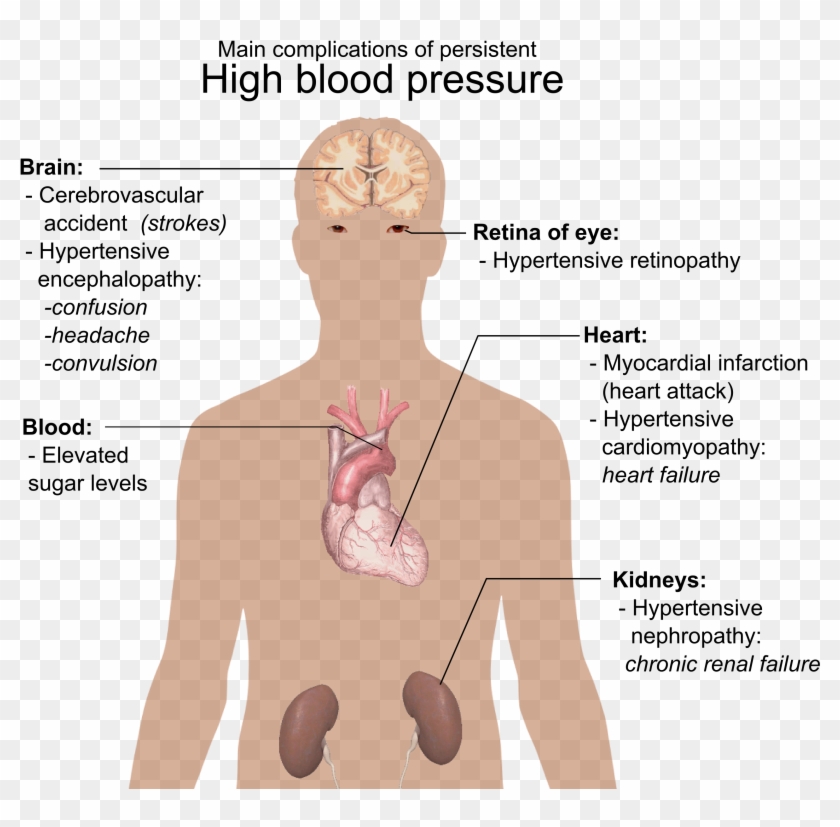 Main Complications Of Persistent High Blood Pressure High Blood main-complications-of-persistent-high-blood-pressure-high-blood