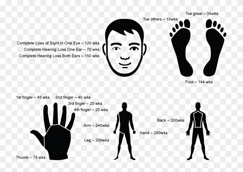 Ppd - Sc Workers Compensation Body Part Value, HD Png Download ...