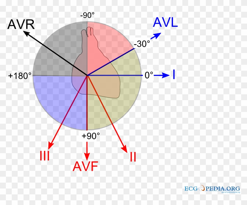Ecg Lead Angulation - Heart Axis, HD Png Download - 794x616(#4425264 ...