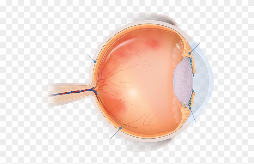 Areas Of The Eye Affected By Uveitis - Circle, HD Png Download ...