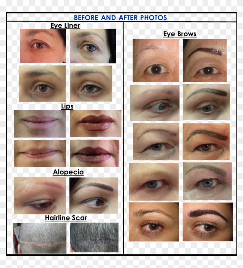 Before And After - Collage, HD Png Download - 900x960(#4743320) - PngFind