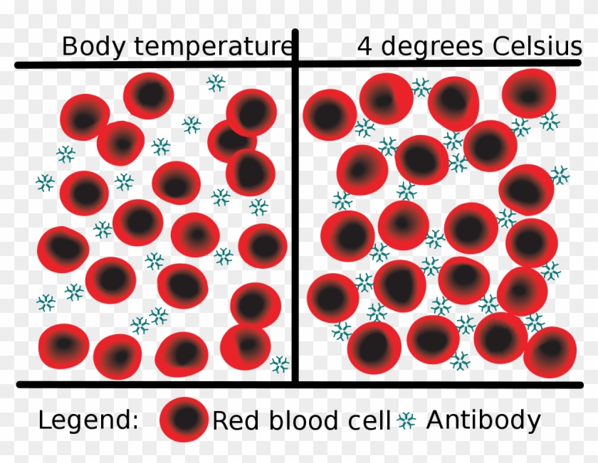 Monospot Test, HD Png Download - 1200x873(#877121) - PngFind